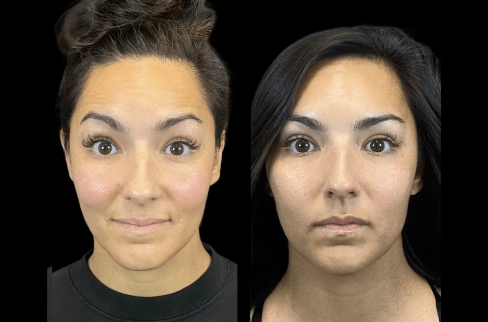 Best Aesthetic Clinic in Dubai: A Complete Guide for First-Time ...